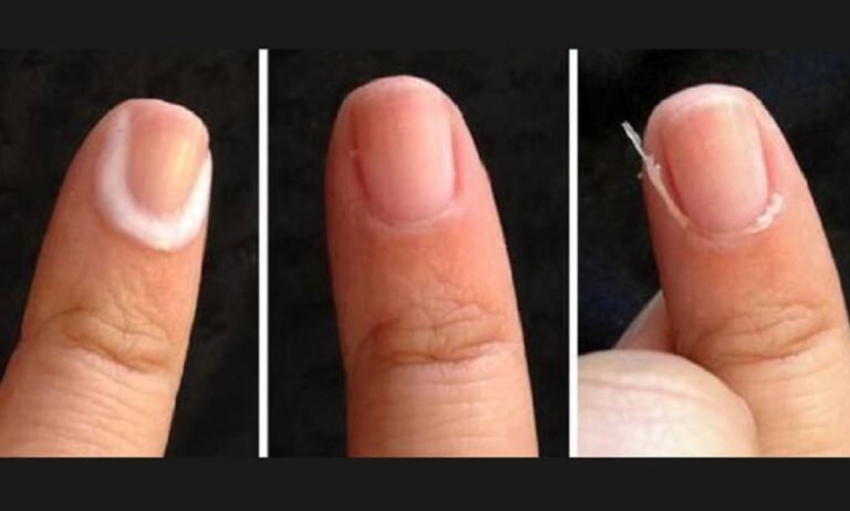 Como Tirar a Cutícula: Dicas e 25 Modelos para não Errar na Cutícula
